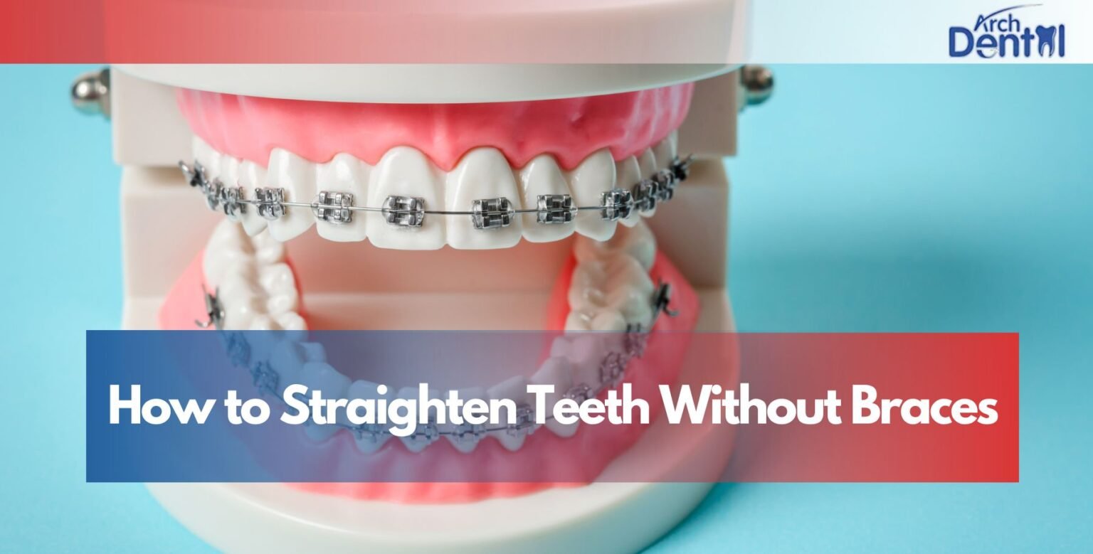 How to Straighten Teeth Without Braces | Arch Dental