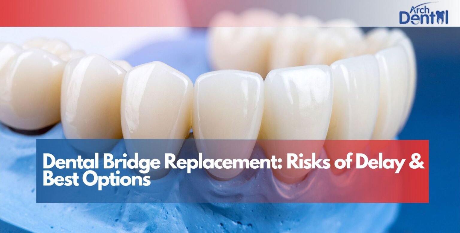 Dental Bridge Replacement | Arch Dental