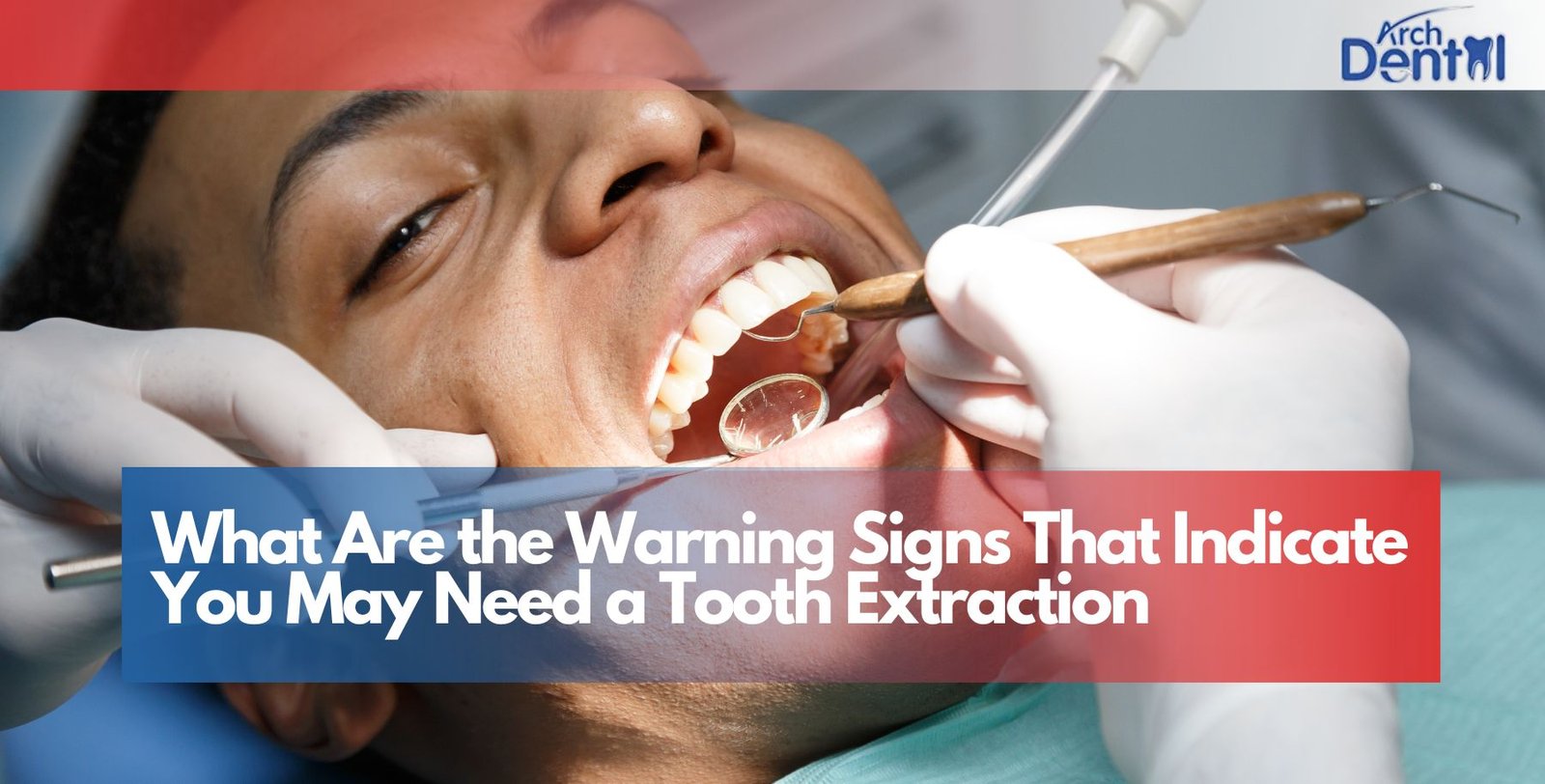 Warning Signs That Indicate You May Need a Tooth Extraction | Arch Dental