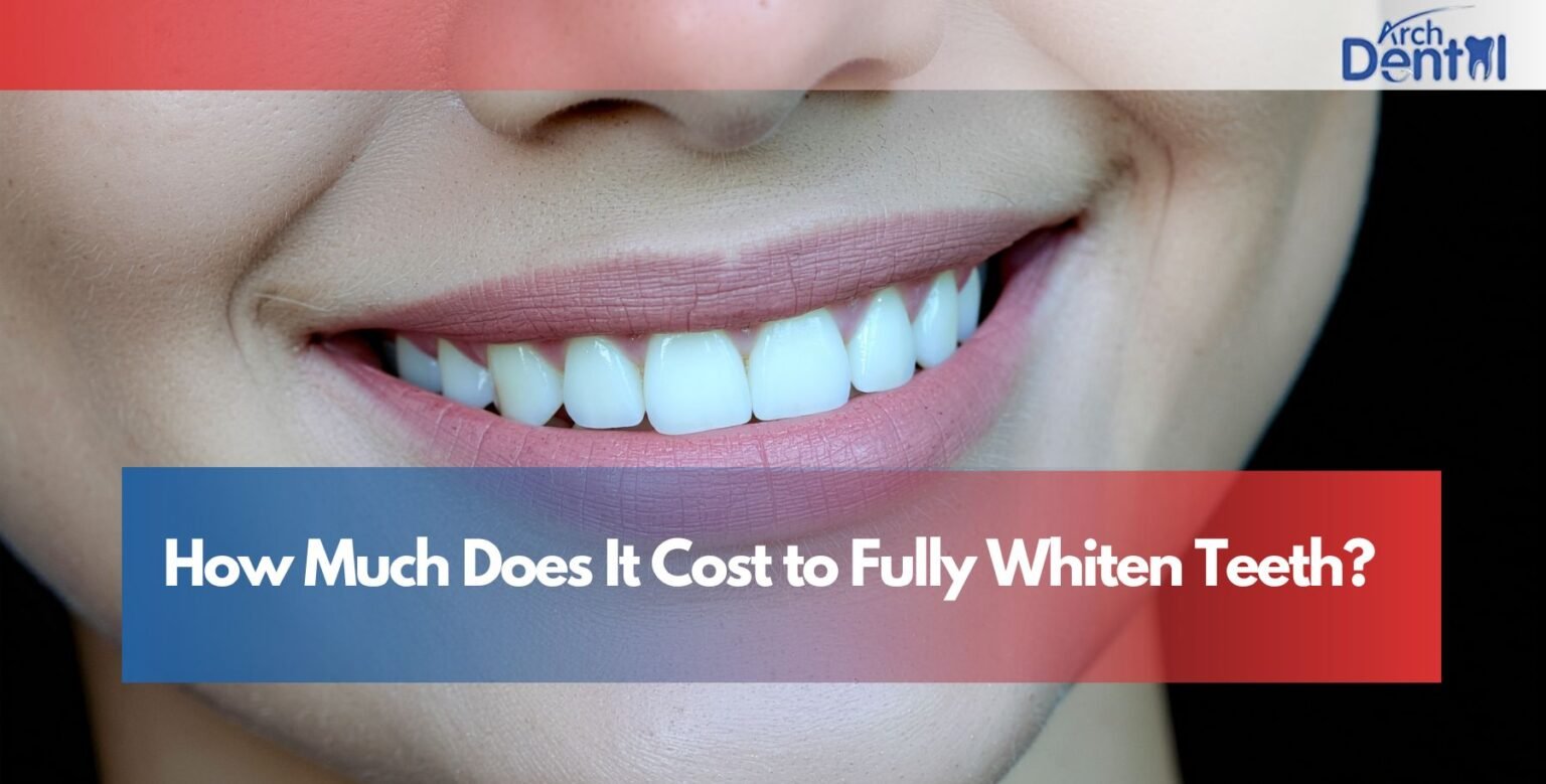 How Much Does It Cost to Fully Whiten Teeth | Arch Dental
