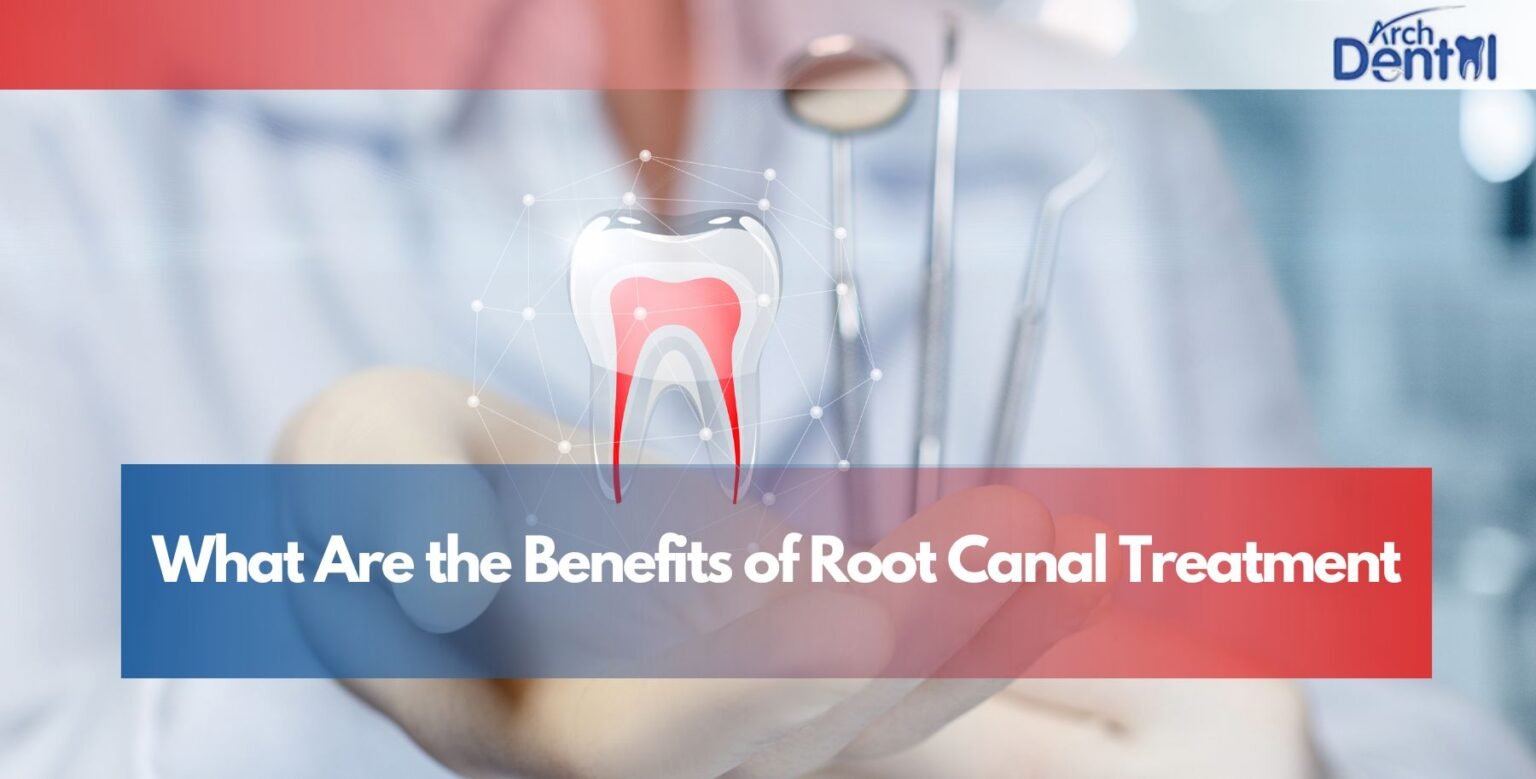 What Are the Benefits of Root Canal Treatment | Arch Dental