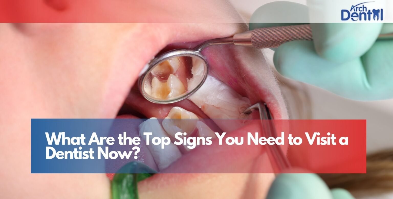 What Are the Top Signs You Need to Visit a Dentist Now | Arch Dental